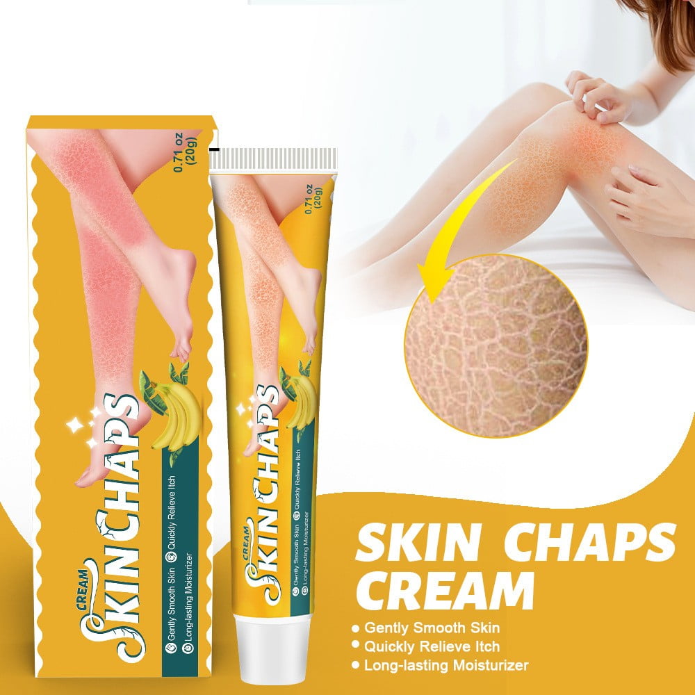 Soften Horny Scales Snake Skin Cream Moisturizing Body Lotion ...