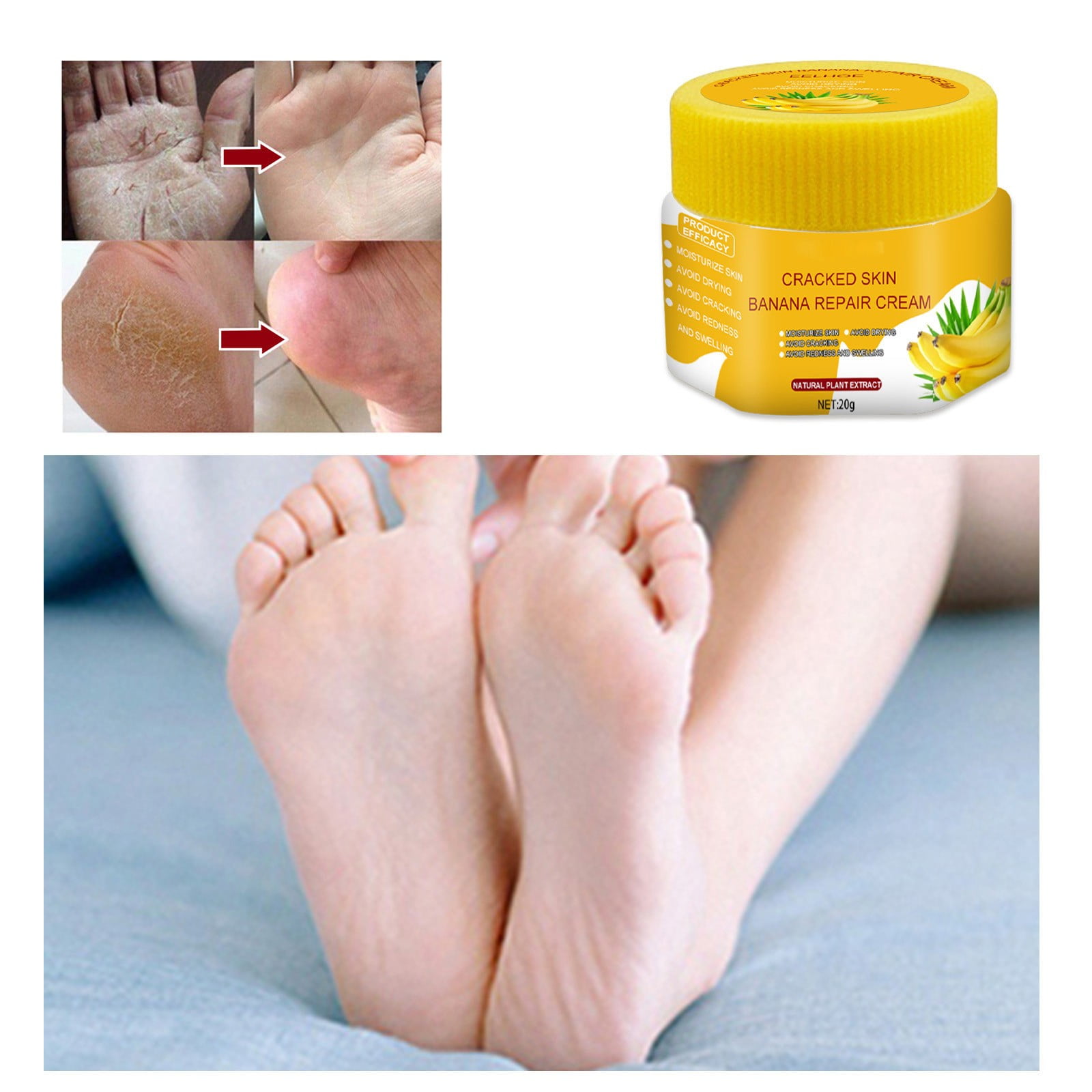 Sonneor Skin Banana Peeling 20g Extremely Dry Feet Climbing Skin File ...