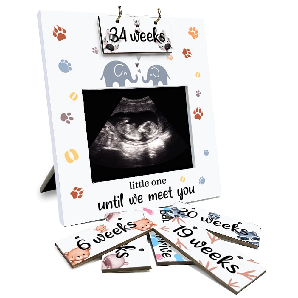 Sonogram Picture Frame Ultrasound Picture Frame with Baby Countdown ...