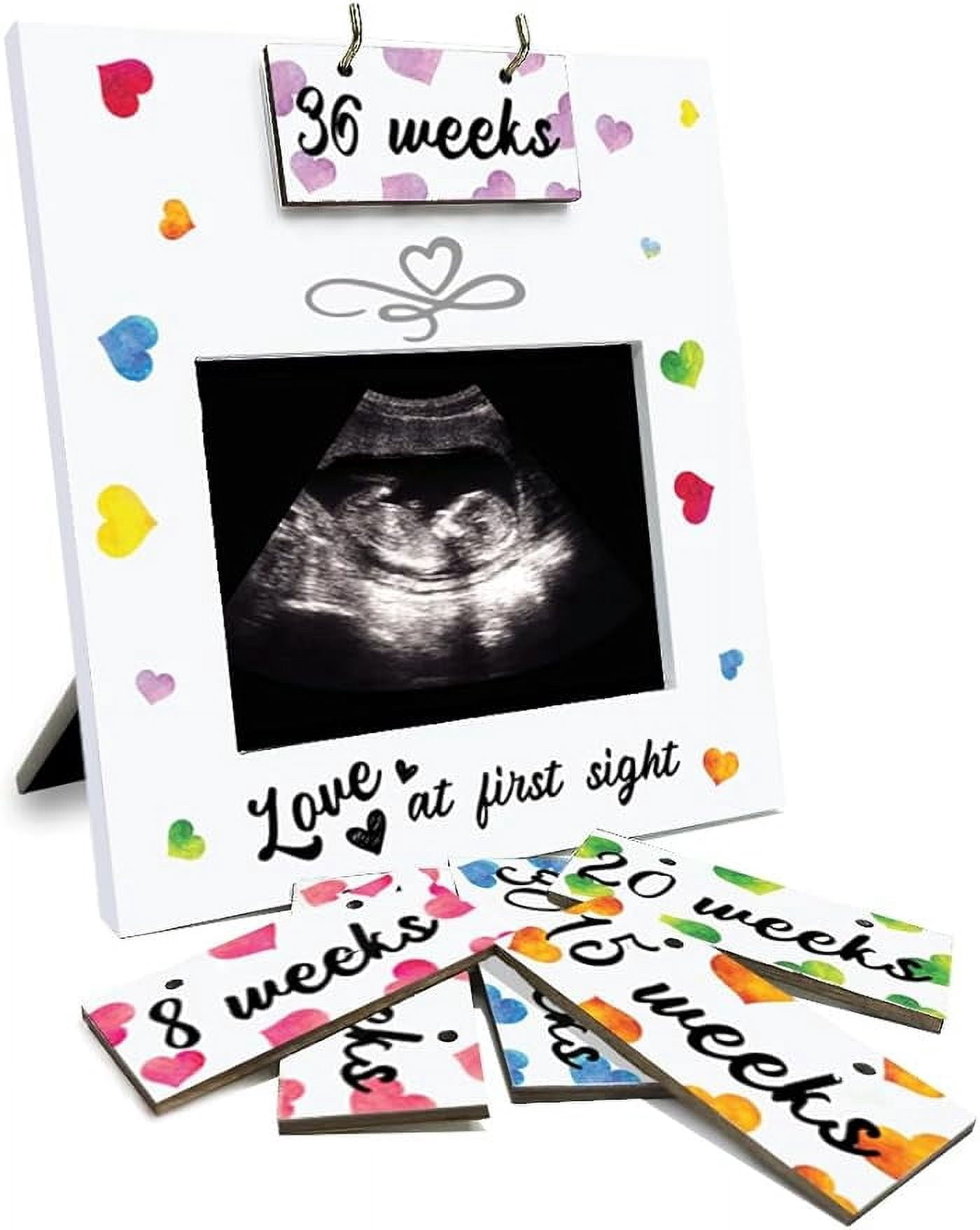 Sonogram Picture Frame Ultrasound Picture Frame with Baby Countdown ...