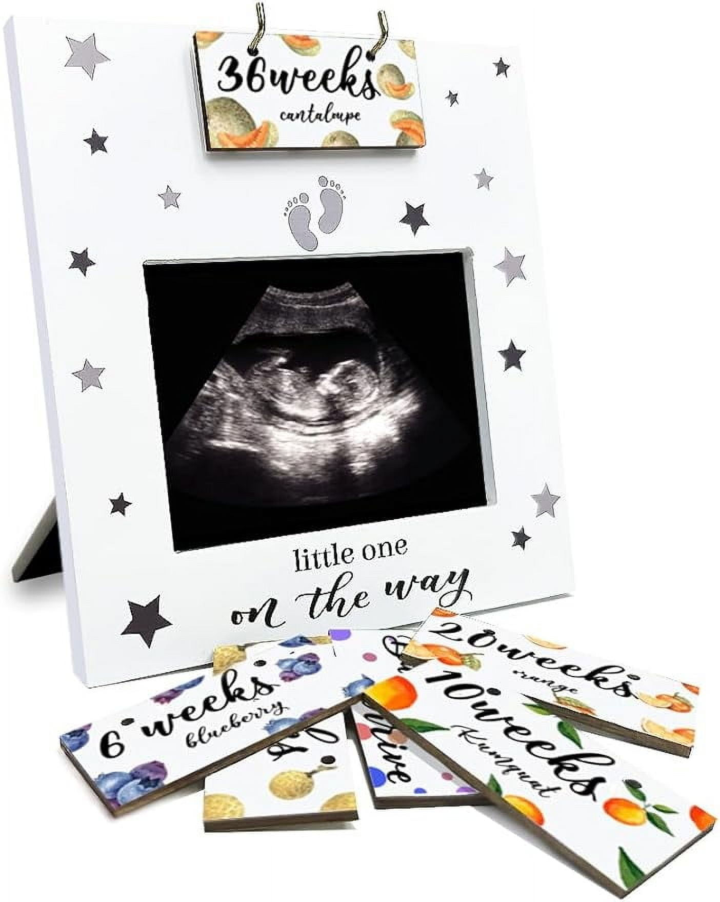 Sonogram Picture Frame Ultrasound Picture Frame with Baby Countdown ...