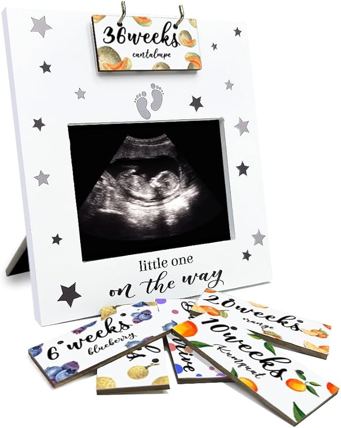 Sonogram Picture Frame Ultrasound Picture Frame with Baby Countdown ...