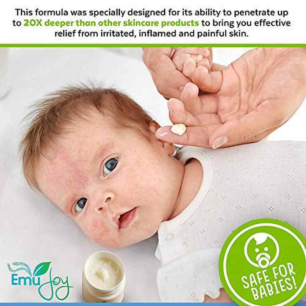 Soothe My Rash Kit for Eczema Psoriasis Lichen Sclerosus Rosacea ...