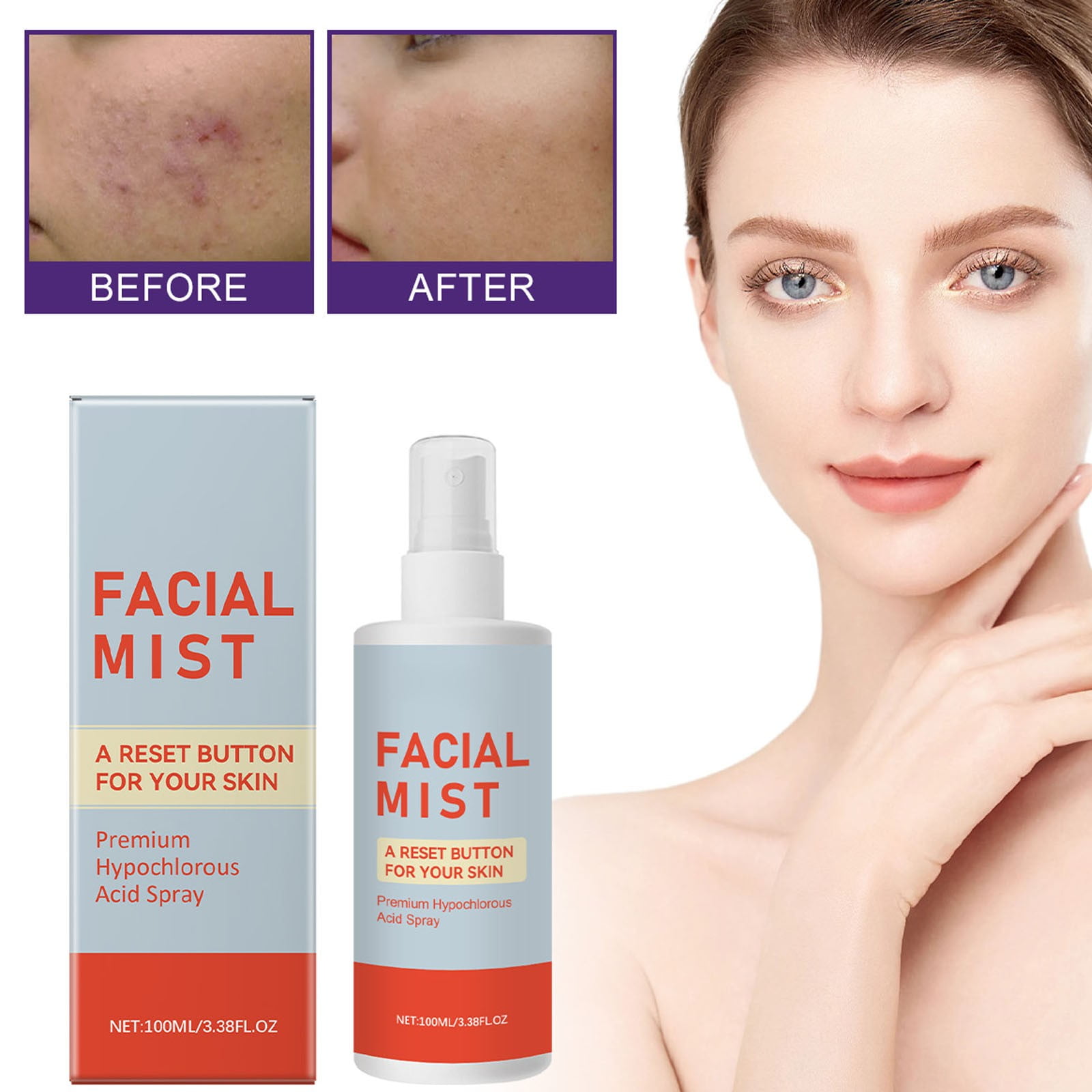 Soothing Calming Spray Oil Control Shrink Pores Repair Pimple Marks For Closed Mouth Redness ...