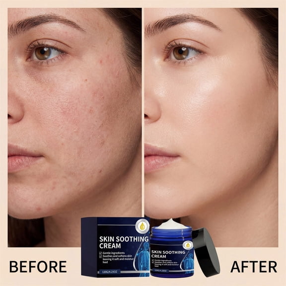 Hydrocerin Cream