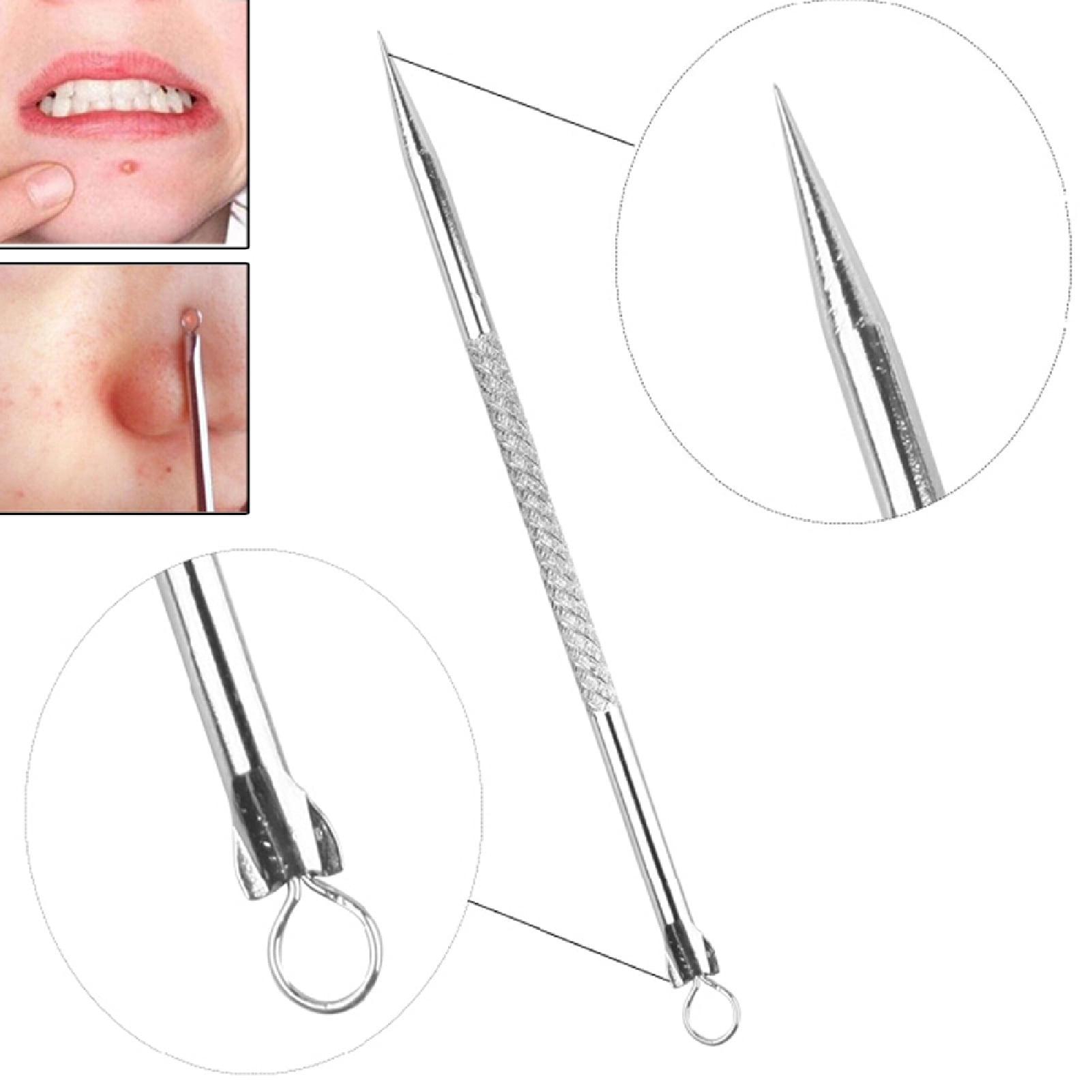 Soumake Comedone Extractor Easy to Use Multi-functional Stainless Steel ...