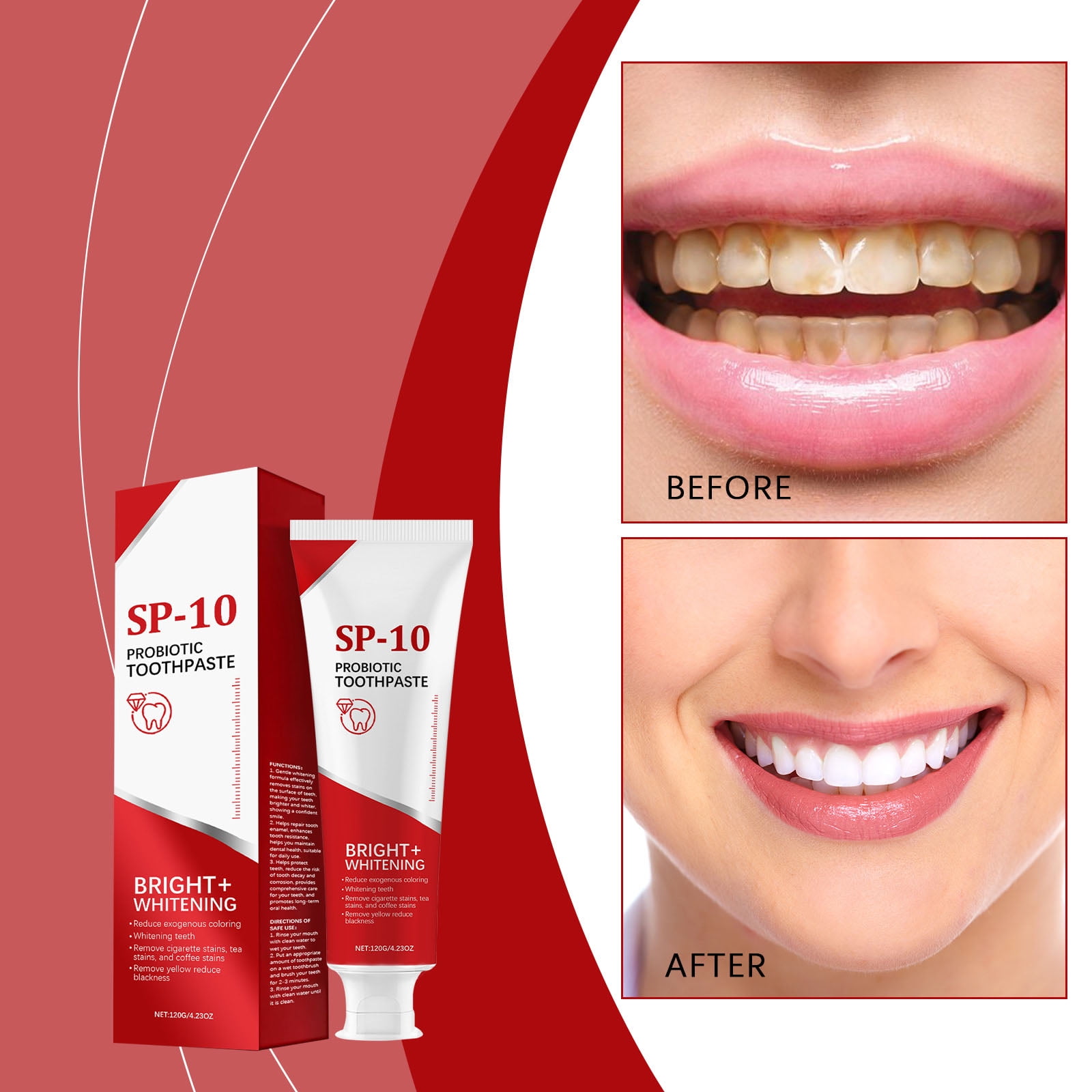 Sp-10 Ultra Toothpaste, SP10 Probiotic Toothpaste, Sp10 Bright White ...