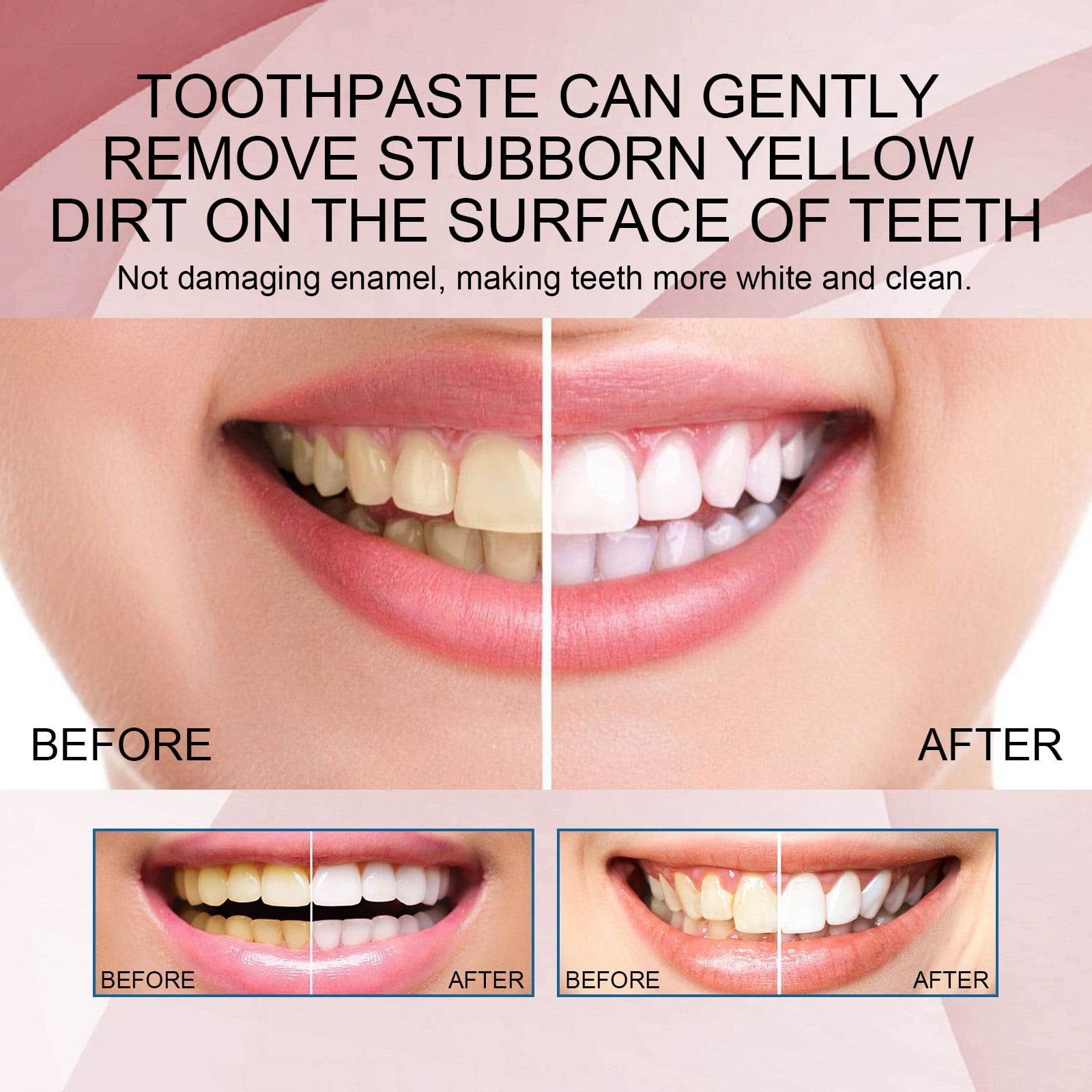 Sp 5 Ultra Sp 5 Toothpaste Super Toothpaste Sp 5 Probiotic Toothpaste ...