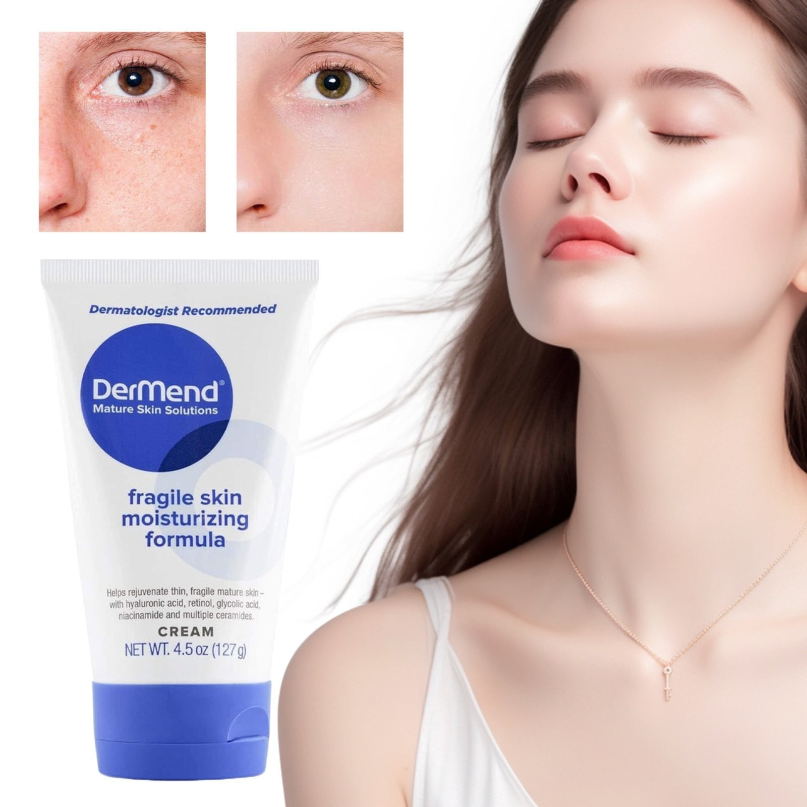 Specialized Fragile Skin Moisturizing Cream: Formula to Restore ...