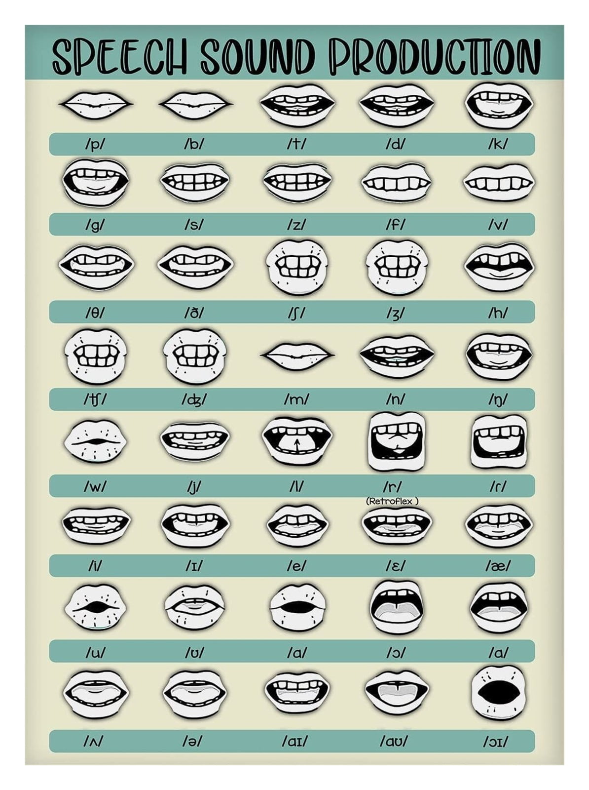 Speech Sound Production Wall Decor Speech Pathology Posters Slp ...