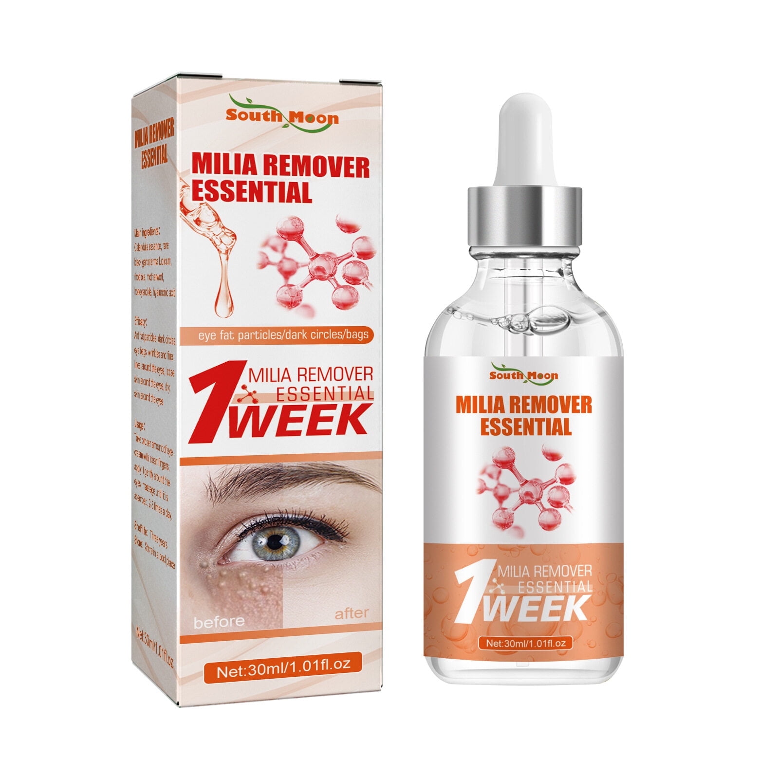 Speedy Milia Remover,30ml Milia Remover Under Eyes, Eye Essential Oil ...