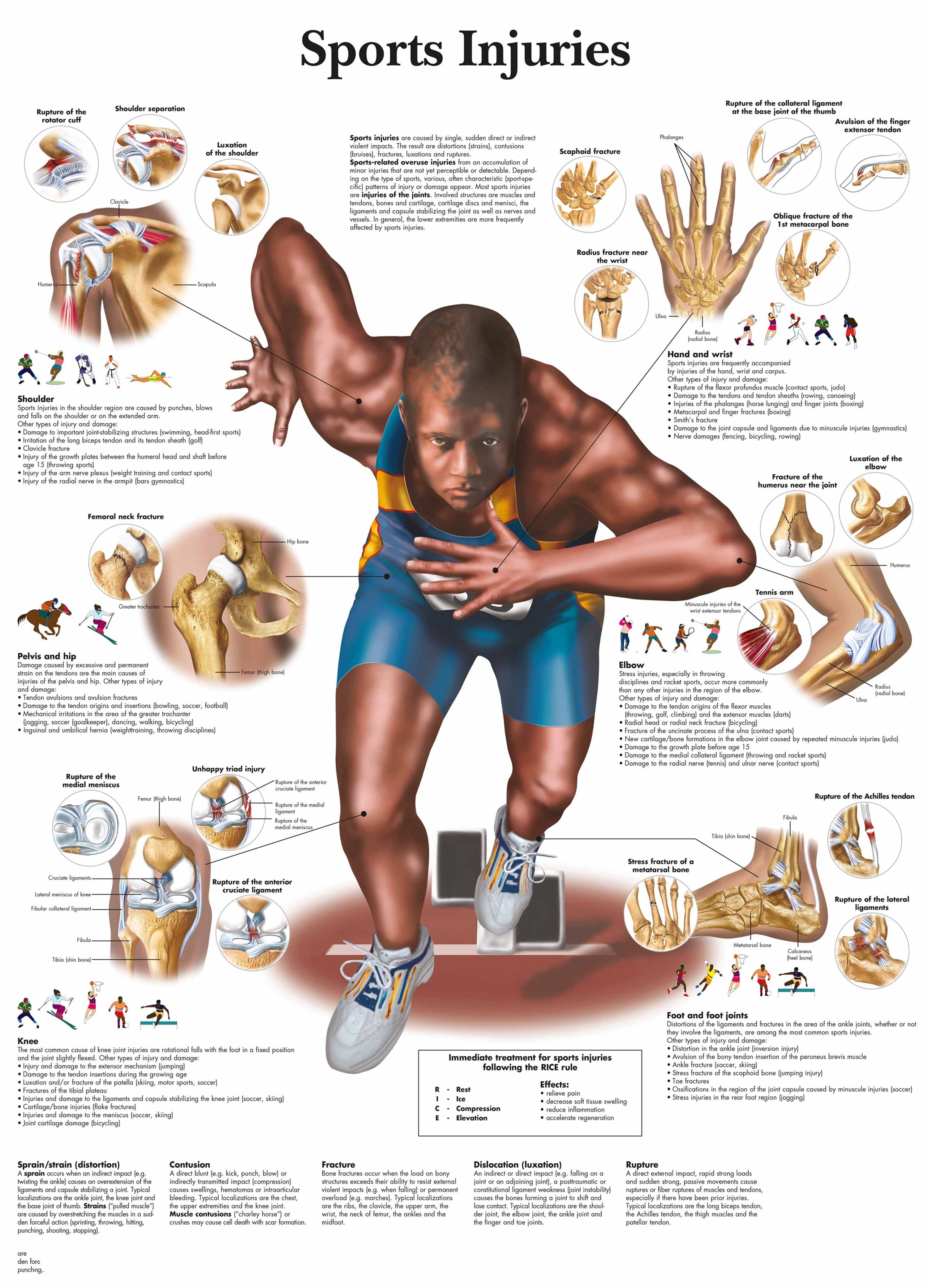 Sports Injuries Wall Art Posters Canvas Print Artwork Wall Chart Human ...
