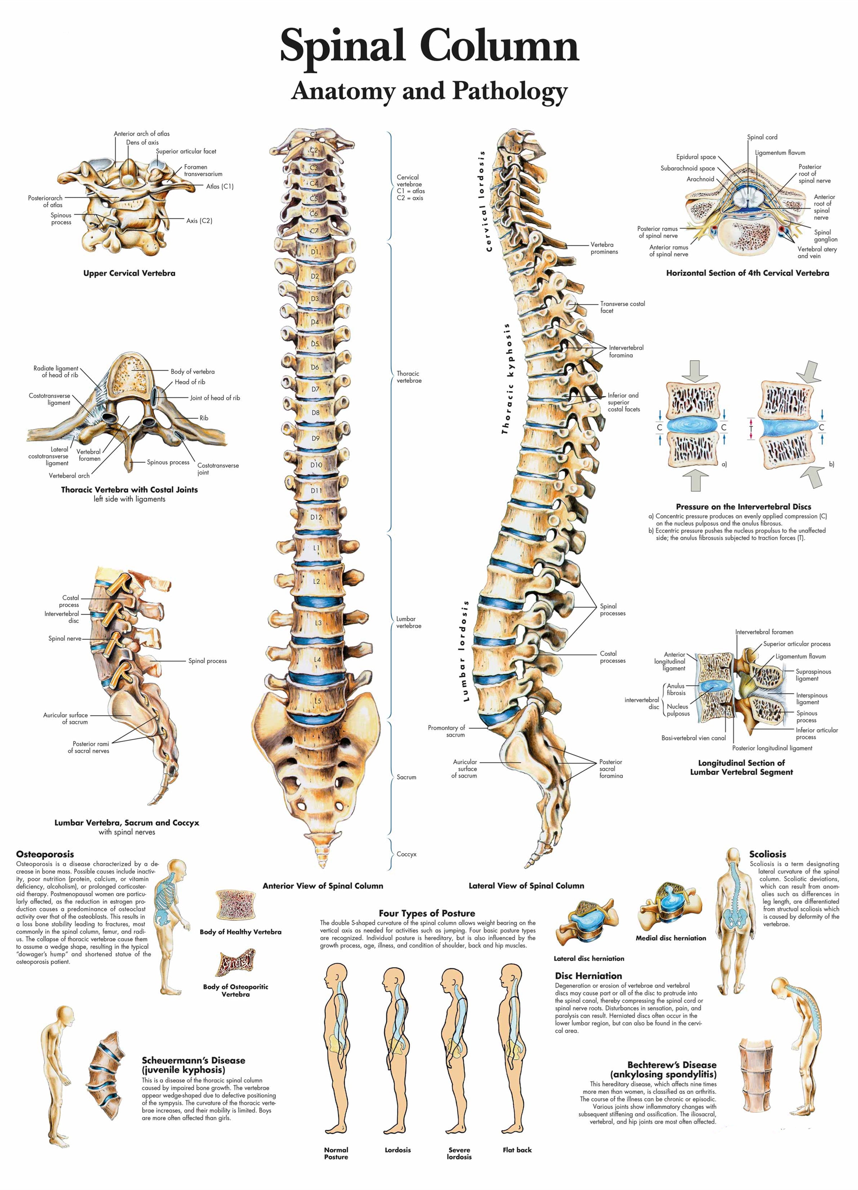 Spinal Column Wall Art Posters Canvas Print Artwork Wall Chart Human ...