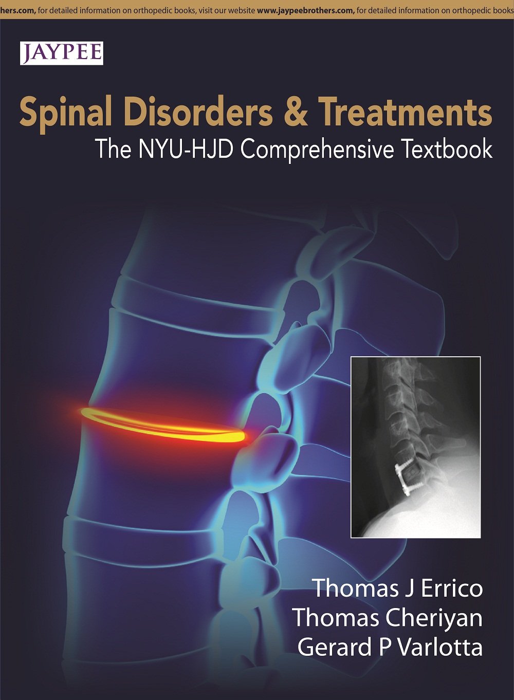 Spinal Disorders and Treatments: The NYU-HJD Comprehensive Textbook ...