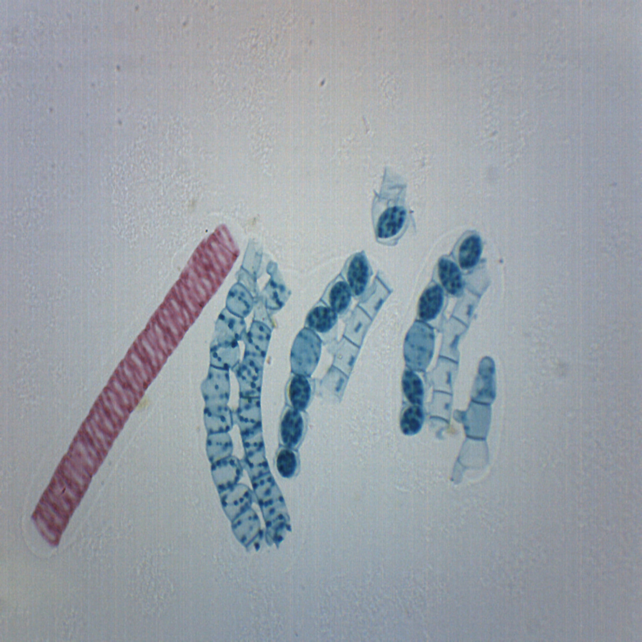 Spirogyra Scalariform, Wholemount - Prepared Microscope Slide - 75 x ...