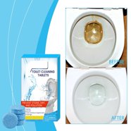 RuWeoMaa Splash Foam Toilet Cleaner, 2025 New Self Activating Miracle ...
