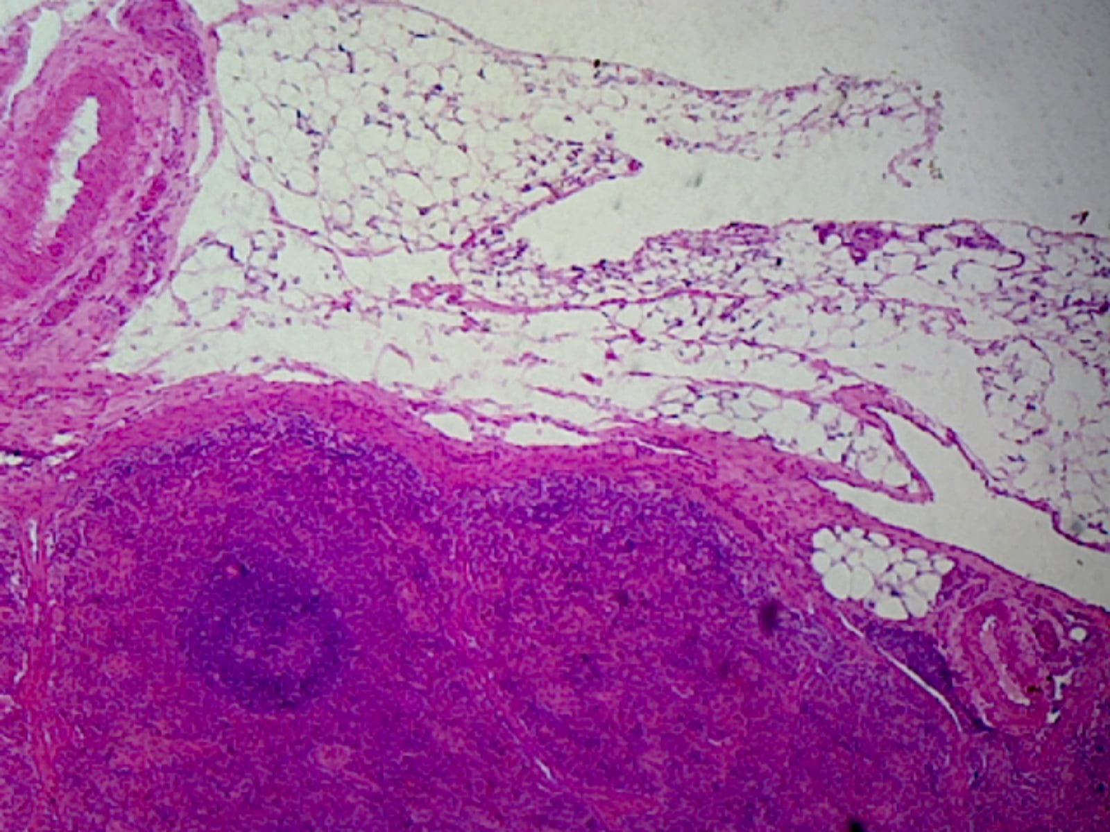 Spleen, Mammalian; Section; H&E Stain by Go Science Crazy - Walmart.com