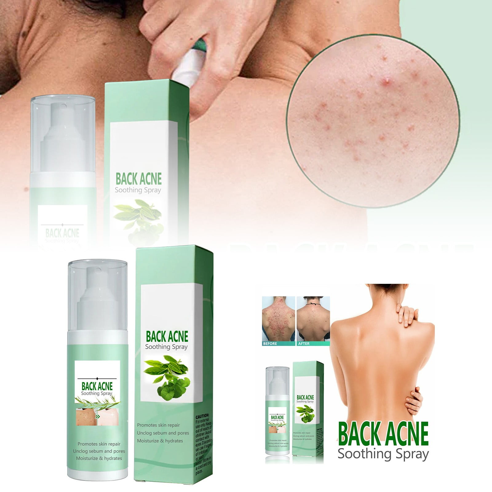 🌟💧 Spray Fade Cleanse Back Moisturize And Smooth Skin Hydrating And ...