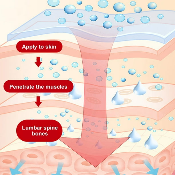 Spray,Numbness And Use Lumbar Pain Intervertebral Care Quick Lumbar ...