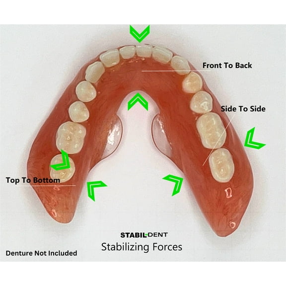 Cushion Grip Dentures