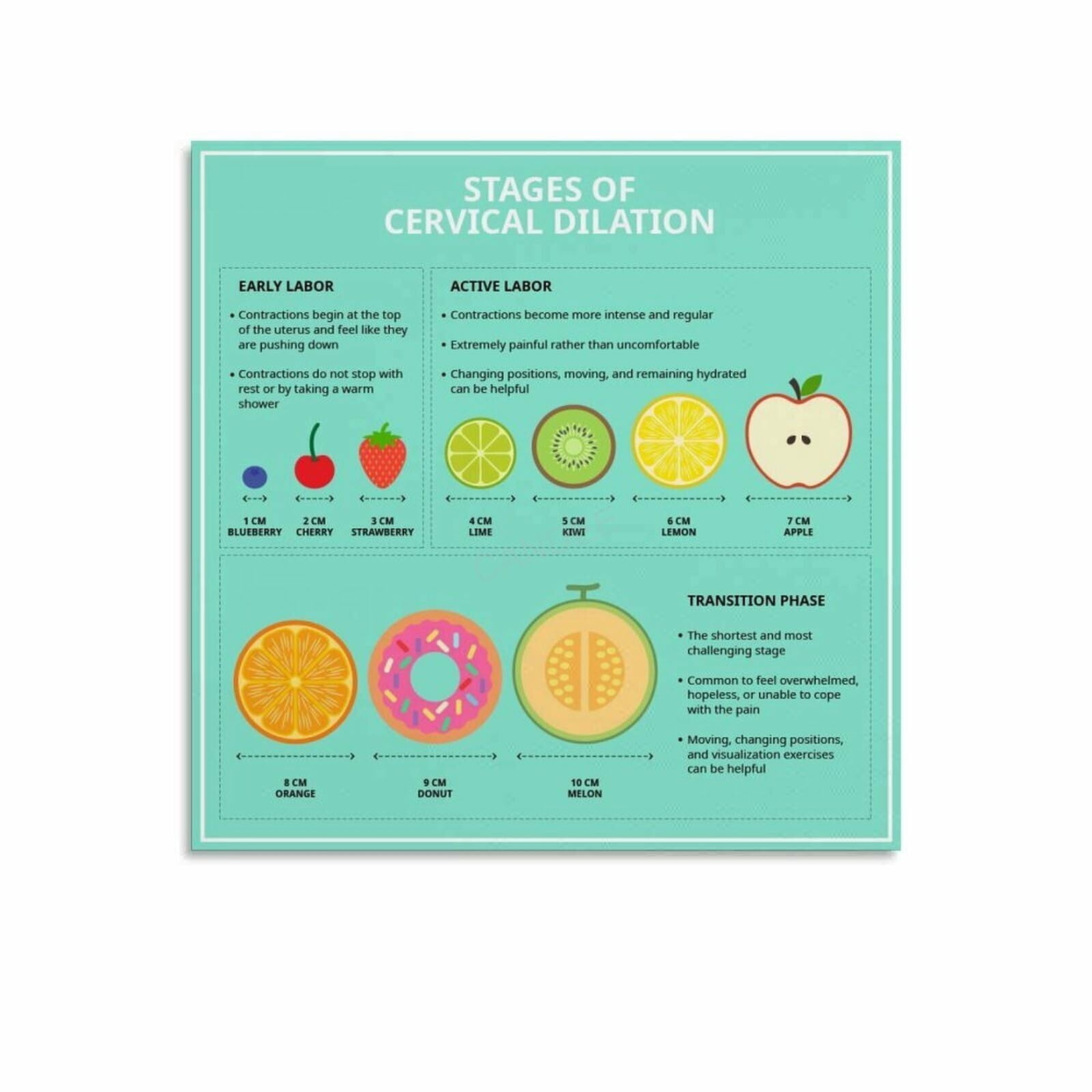 Stages Of Cervical Dilation In Labour Poster Childbirth Birth Class (1 ...