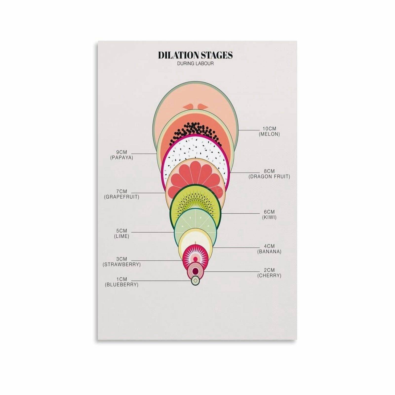Stages Of Cervical Dilation In Labour Poster Childbirth Birth Class (4 ...