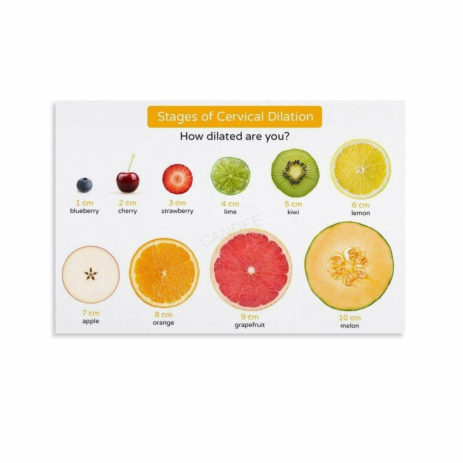 Stages Of Cervical Dilation In Labour Poster Childbirth Birth Class (6 ...