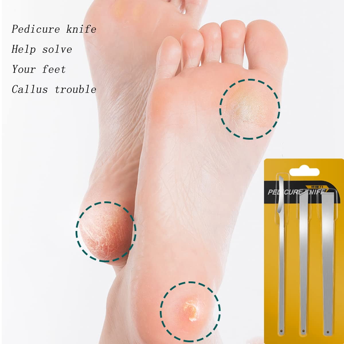 Stainless Steel Ingrown Toenail Pedicure Knife Set,Professional Foot ...