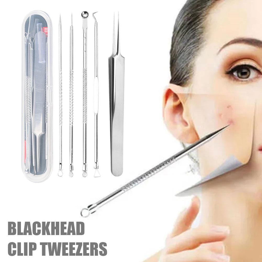 Stainless Steel Pimple Popper Tool Kit - 5 Pcs Blackhead Removal Set ...