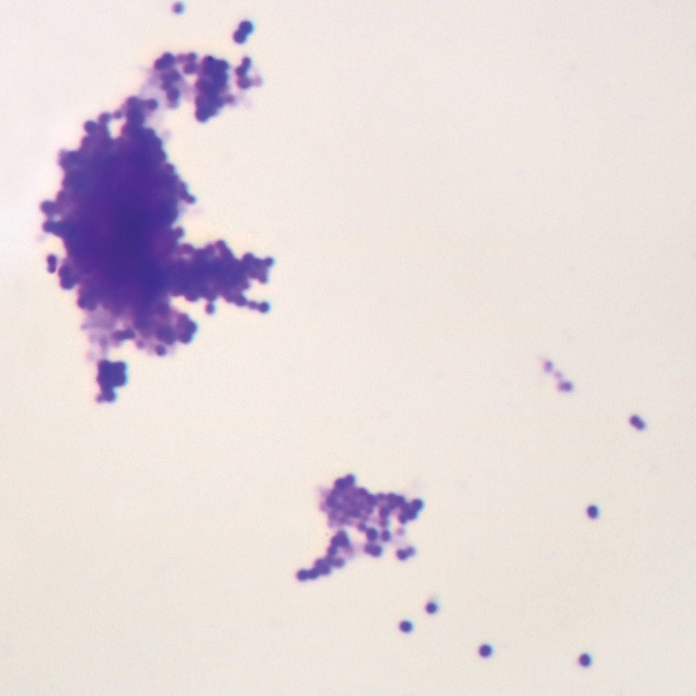 Staphylococcus Epidermidis, W.M. Microscope Slide - Walmart.com