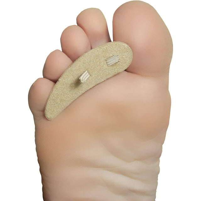 Steins Hammer Toe Crest Cushion and Buttress Pad Reduces Pressure from ...