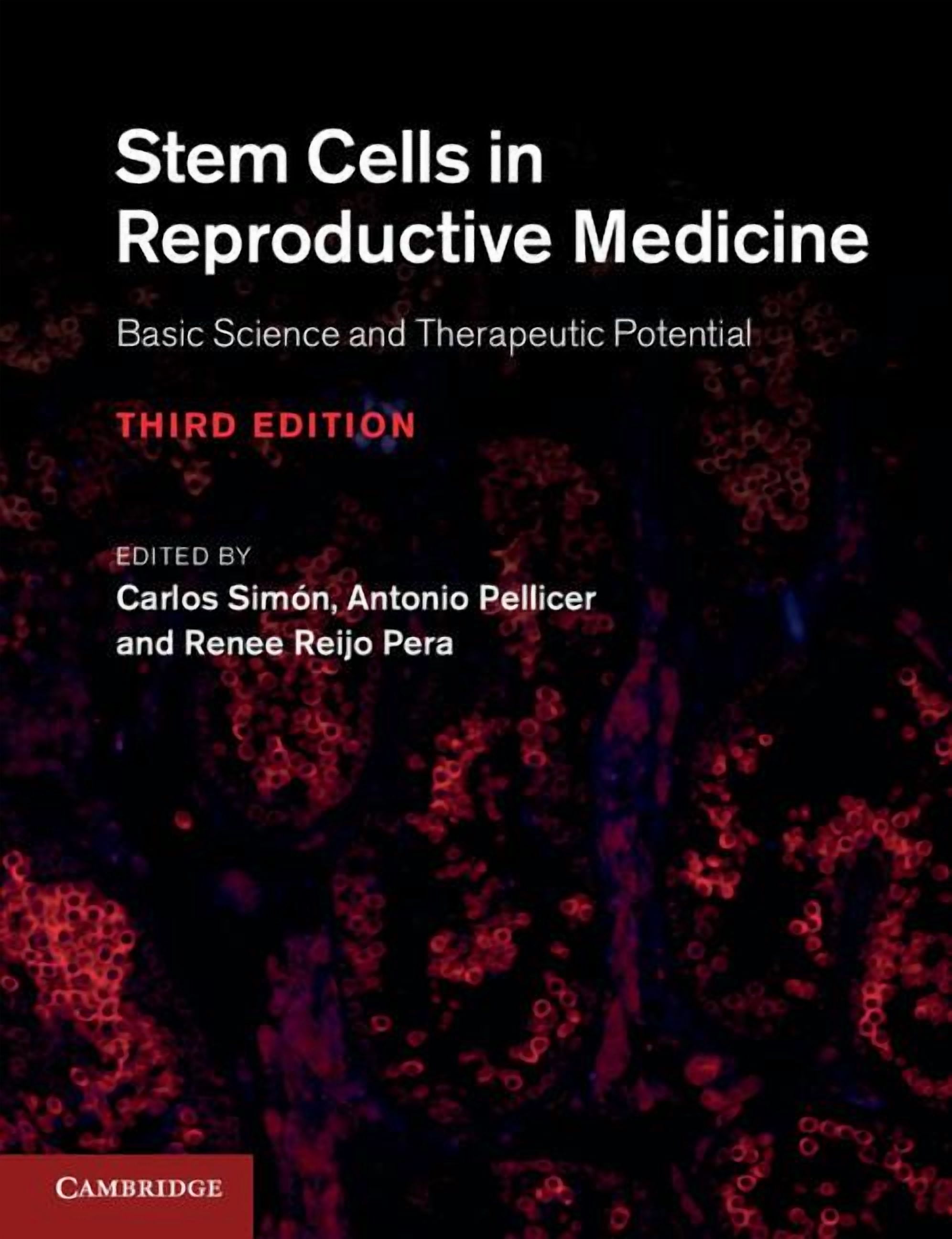 Stem Cells in Reproductive Medicine: Basic Science and Therapeutic ...