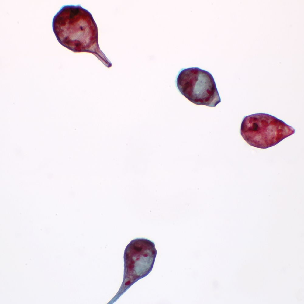 Stentor Prepared Microscope Slide, Whole-Mount - Walmart.com