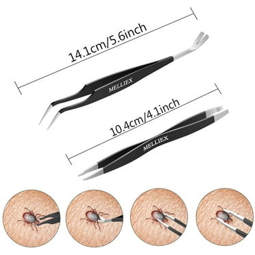 Tickcheck 3 Pack Tick Remover Kit for Pets, Humans, Dogs & Cats with ...