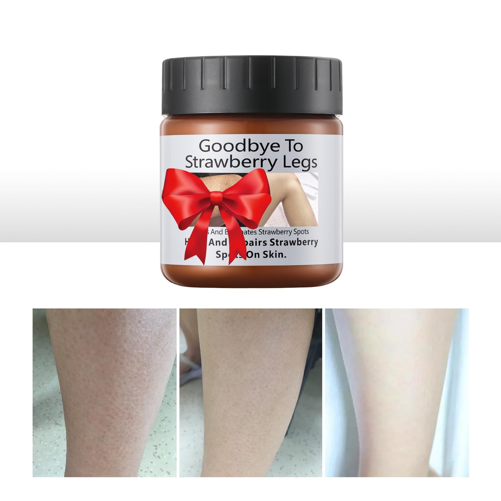 Strawberry Legs Treatment Cream IRF13 For Women Keratosis Pilaris ...