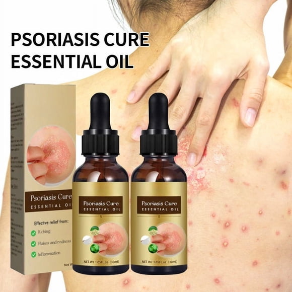 Anti Itch Essential Oils