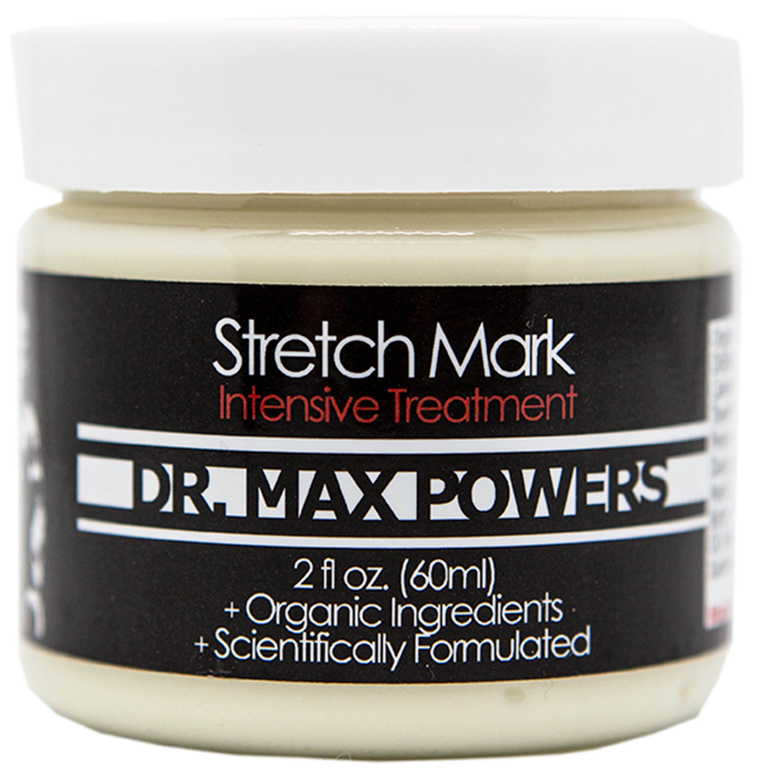 Fast & Effective Stretch Mark Treatment for Men and Women, Works on New ...