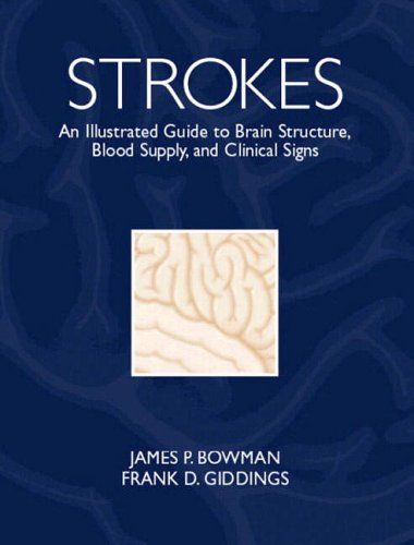 Pre-Owned Strokes: An Illustrated Guide to Brain Structure, Blood ...