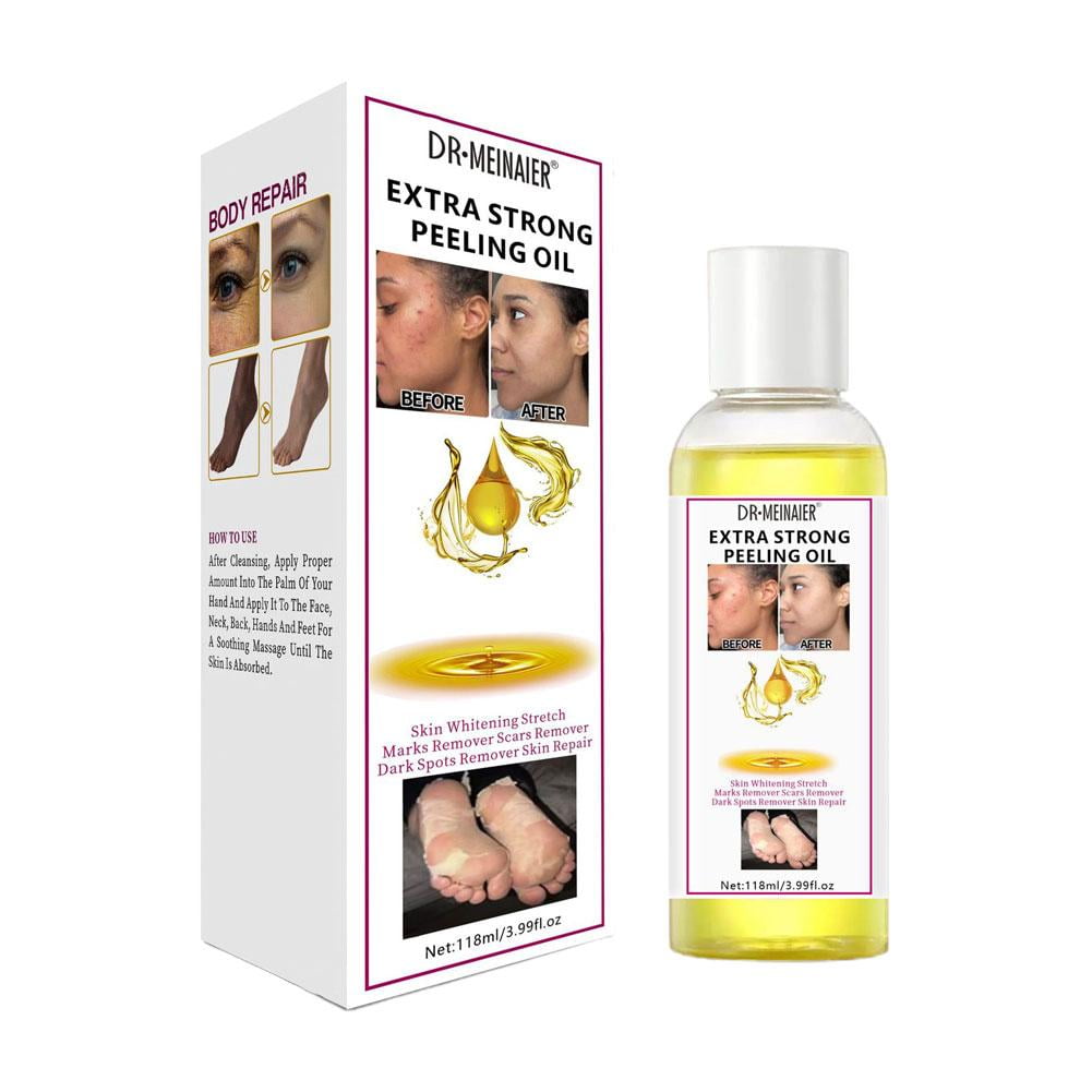 Strong Yellow Peeling Oil Exfoliating Solution for Face Body Dark Skin ...