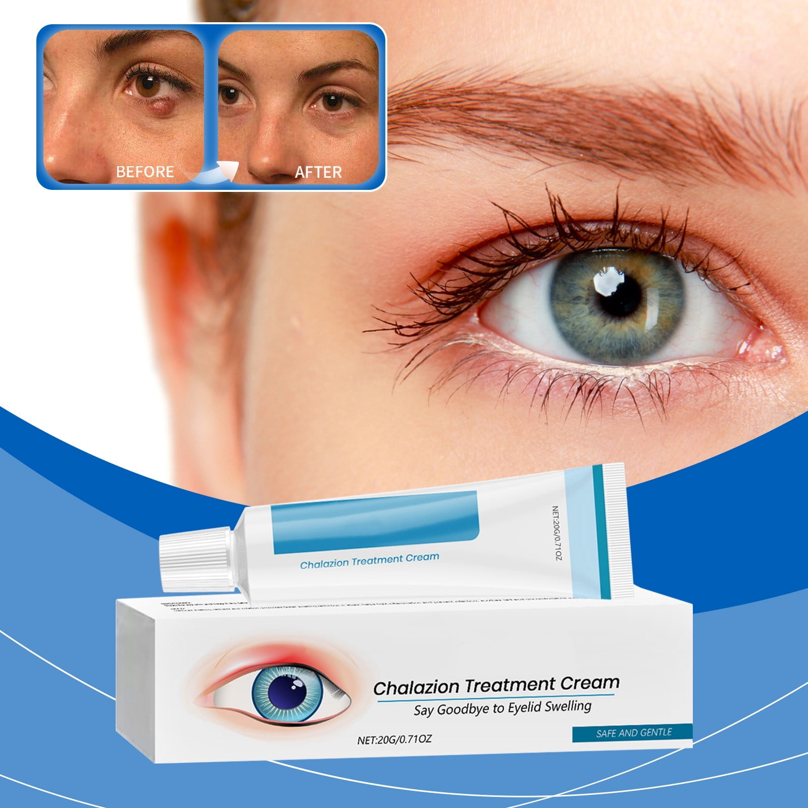 Stye Eye Soothing Cream Firming Eye Cream Lightens Eye Wrinkles ... Stye Eye Soothing Cream Firming Eye Cream Lightens Eye Wrinkles ...