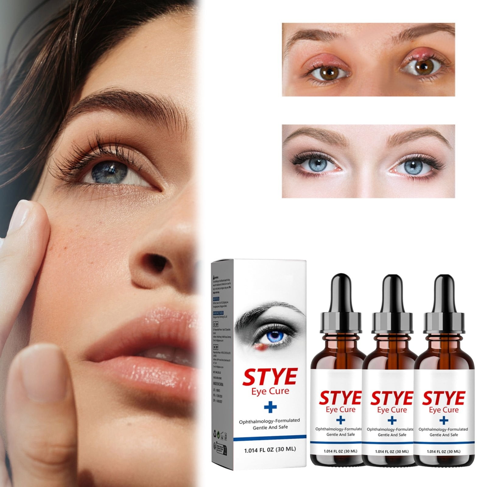 Stye Eyes Treatment,Chalazion Remover,Stye Eye Relief Serum for Styes ...