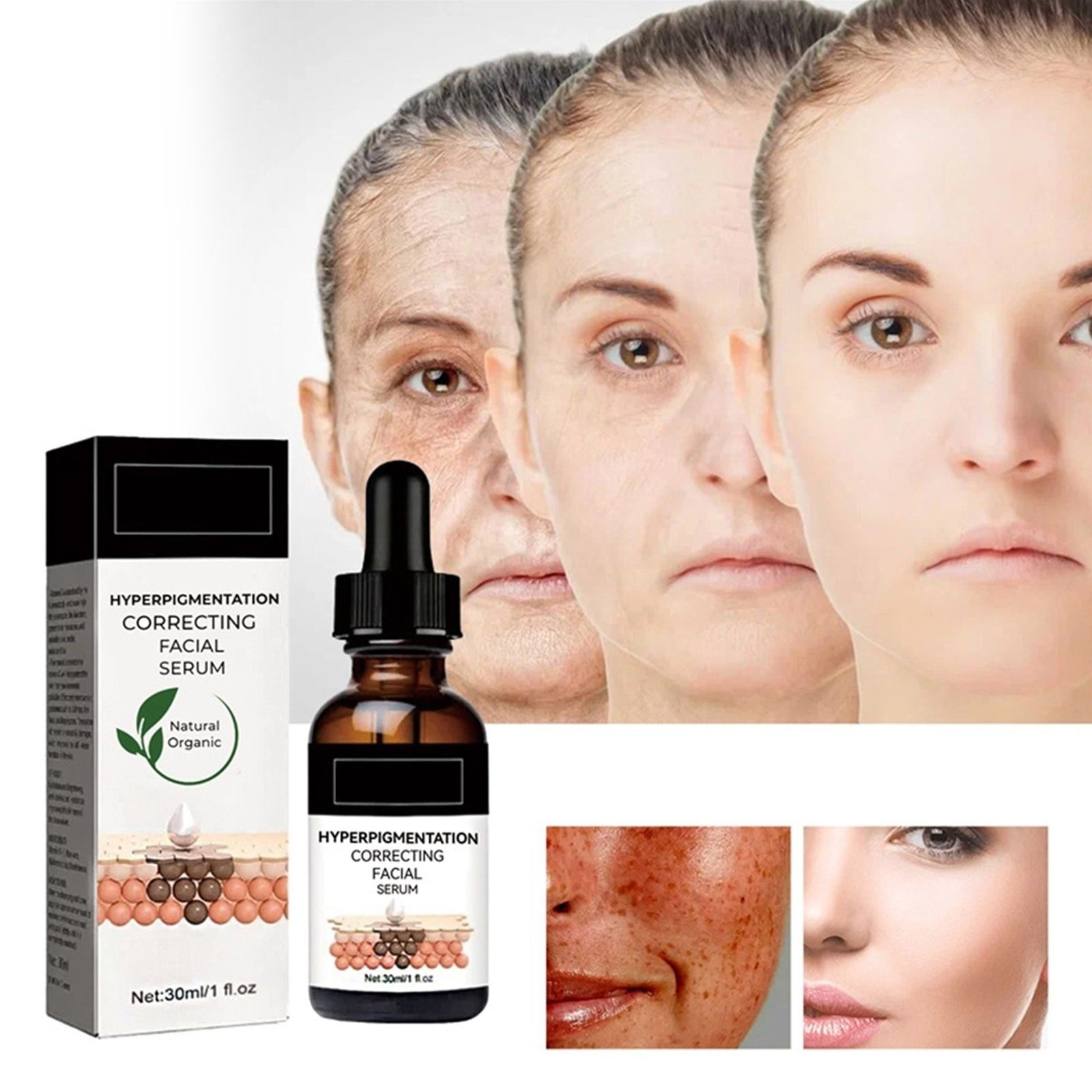 Style Refresh, Melanin Correcting Serum, Dark Corrector, Skin Tone ...