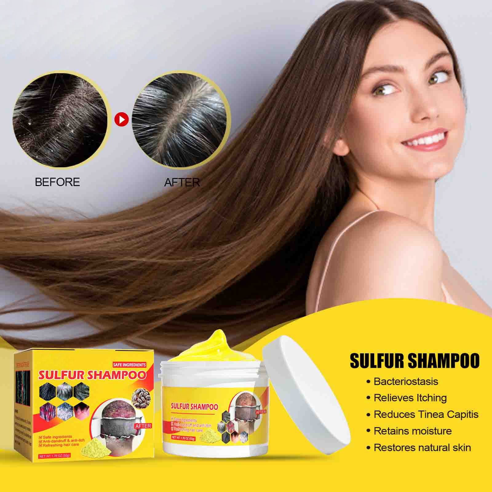 Sulfur Shampoo - Relieve Itching, Control Oil, And Refresh, Sulfur ...