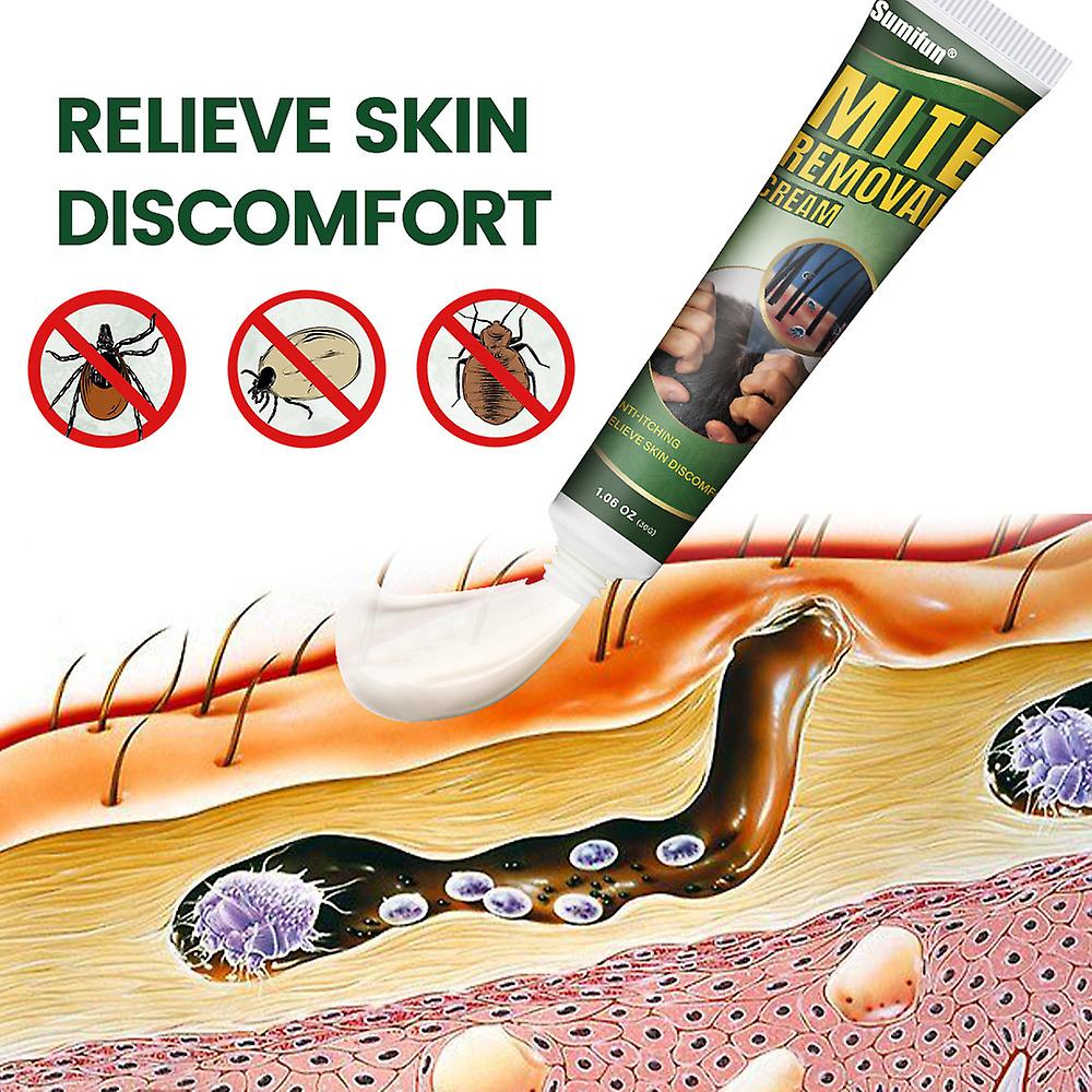 Sumifun Head Mite Removal Cream Scalp Itching Relieve Antibacterial ...