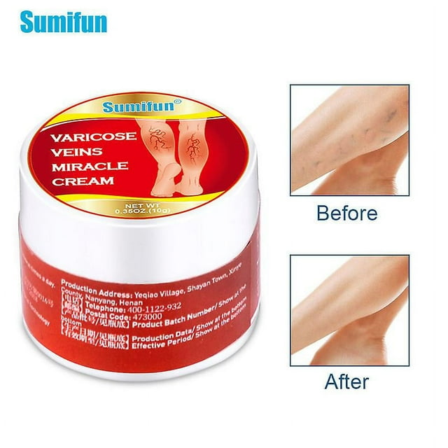 Sumifun Mai Shuning Cream Leg Cramps, Blue Veins, Bulging Pain Cream ... Sumifun Mai Shuning Cream Leg Cramps, Blue Veins, Bulging Pain Cream ...