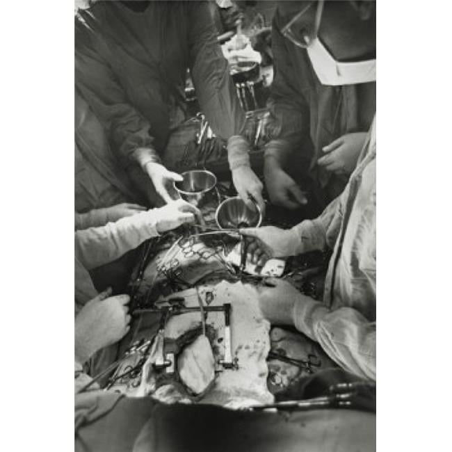Superstock SAL990118163 High Angle View of Surgeons Performing Open ...