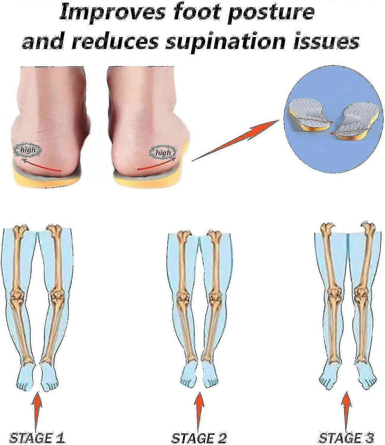 Supination Insoles For Over Supination & High Arch Support,orthotic Inserts For Foot Alignment ...