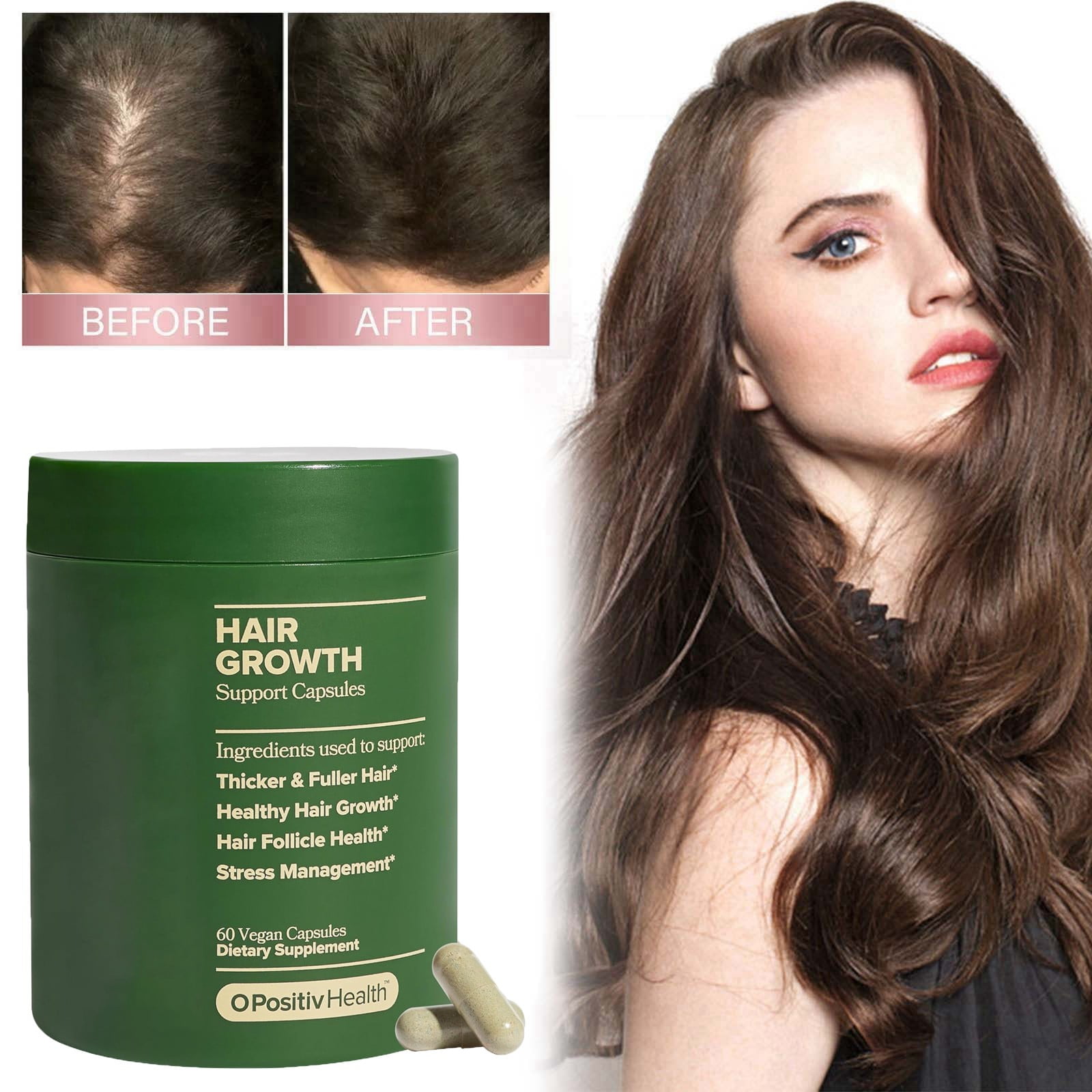Support for Women Supports Thicker Fuller Hair Hair for Hair Loss ...