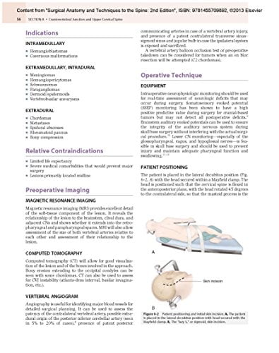 Pre-Owned Surgical Anatomy and Techniques to the Spine: Expert Consult ...