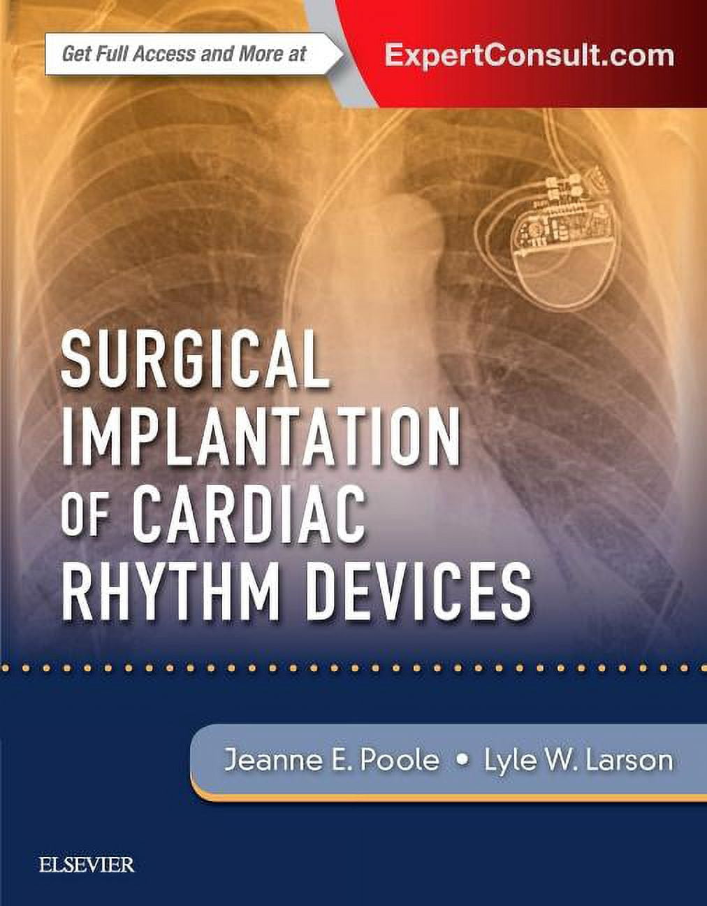 Surgical Implantation of Cardiac Rhythm Devices (Hardcover) by Jeanne ...